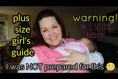 ≫ How To Keep C Section Incision Dry When Overweight - The Dizaldo Blog!